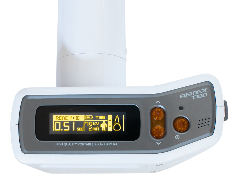 Remedi Remex T-100 Handheld X-Ray – Portable Dental Intraoral Imaging ...